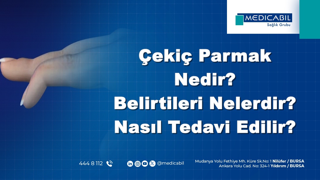 Blog | Çekiç Parmak Nedir? Belirtileri Nelerdir? Nasıl Tedavi Edilir?