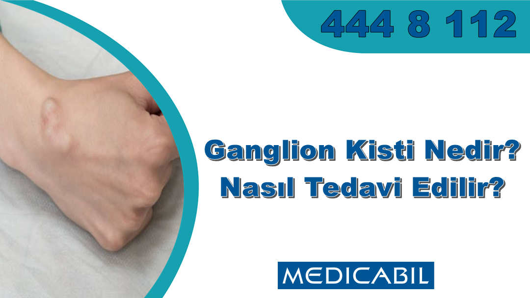 Blog | Ganglion Kisti Nedir? Nasıl Tedavi Edilir?