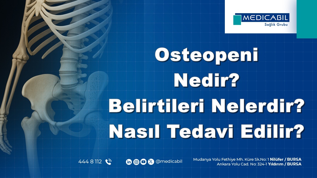 Blog | Osteopeni Nedir? Belirtileri Nelerdir? Nasıl Tedavi Edilir?