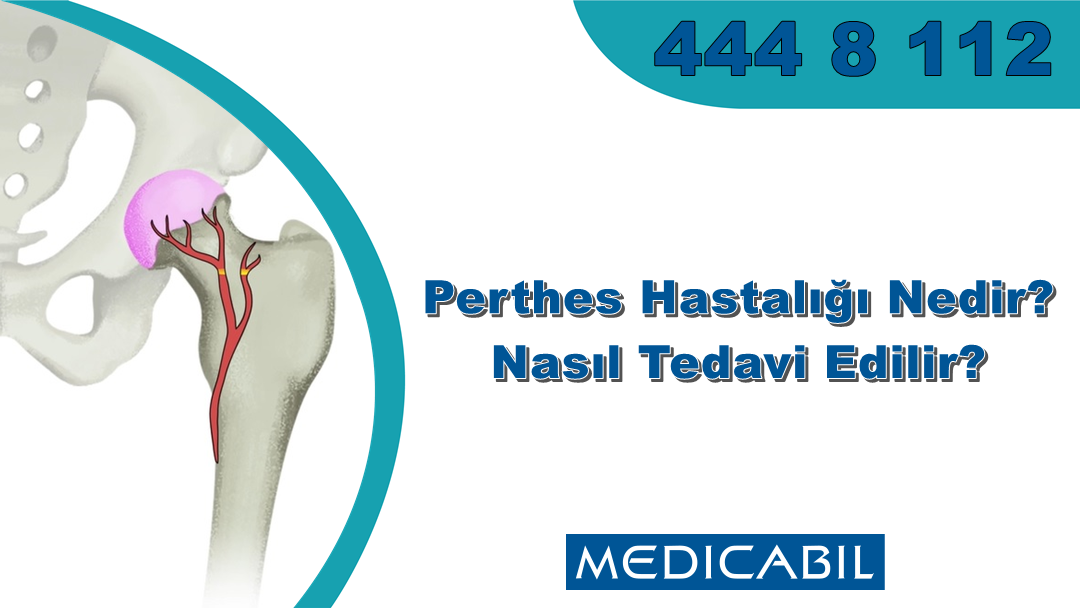 Blog | Perthes Hastalığı Nedir? Nasıl Tedavi Edilir?