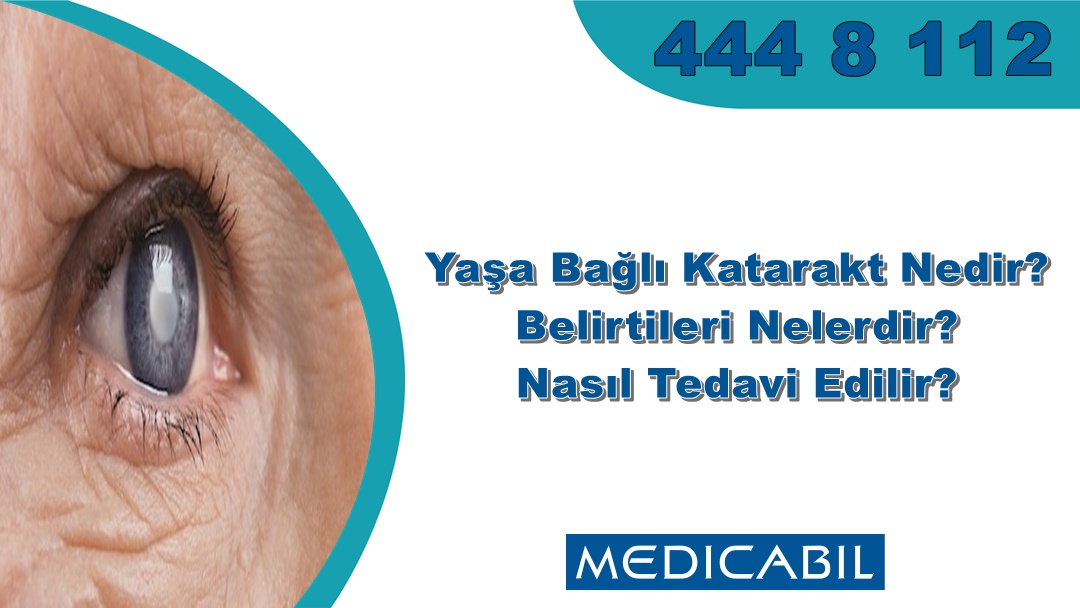 Blog | Yaşa Bağlı Katarakt Nedir? Belirtileri Nelerdir? Nasıl Tedavi Edilir?